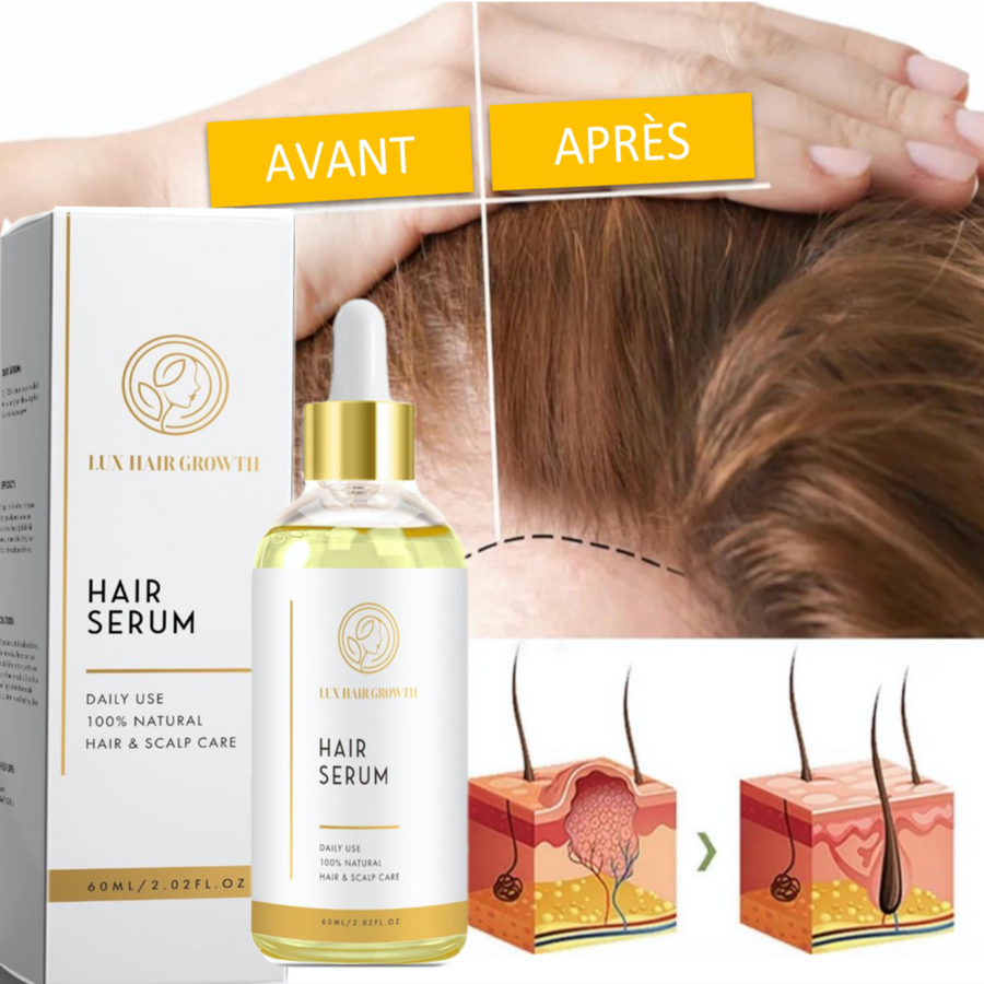 LUX'HAIR GROWTH | Site Officiel® - Luxhairgrowth.fr