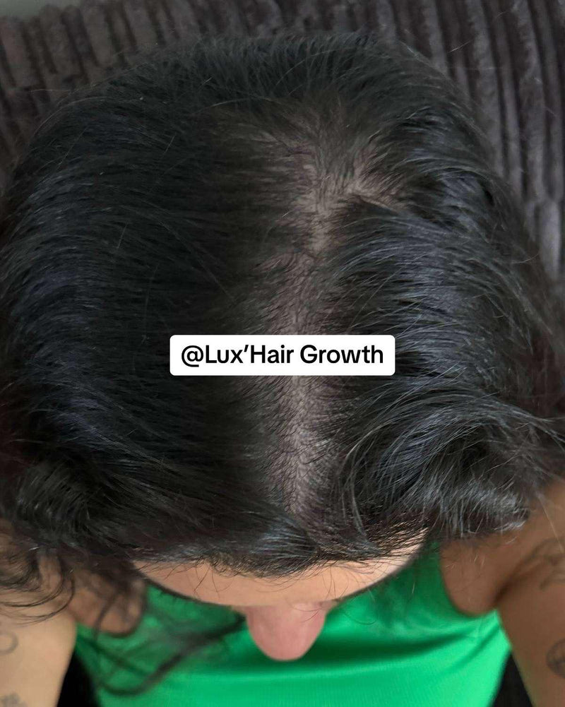 LUX'HAIR GROWTH | Site Officiel® - Luxhairgrowth.fr